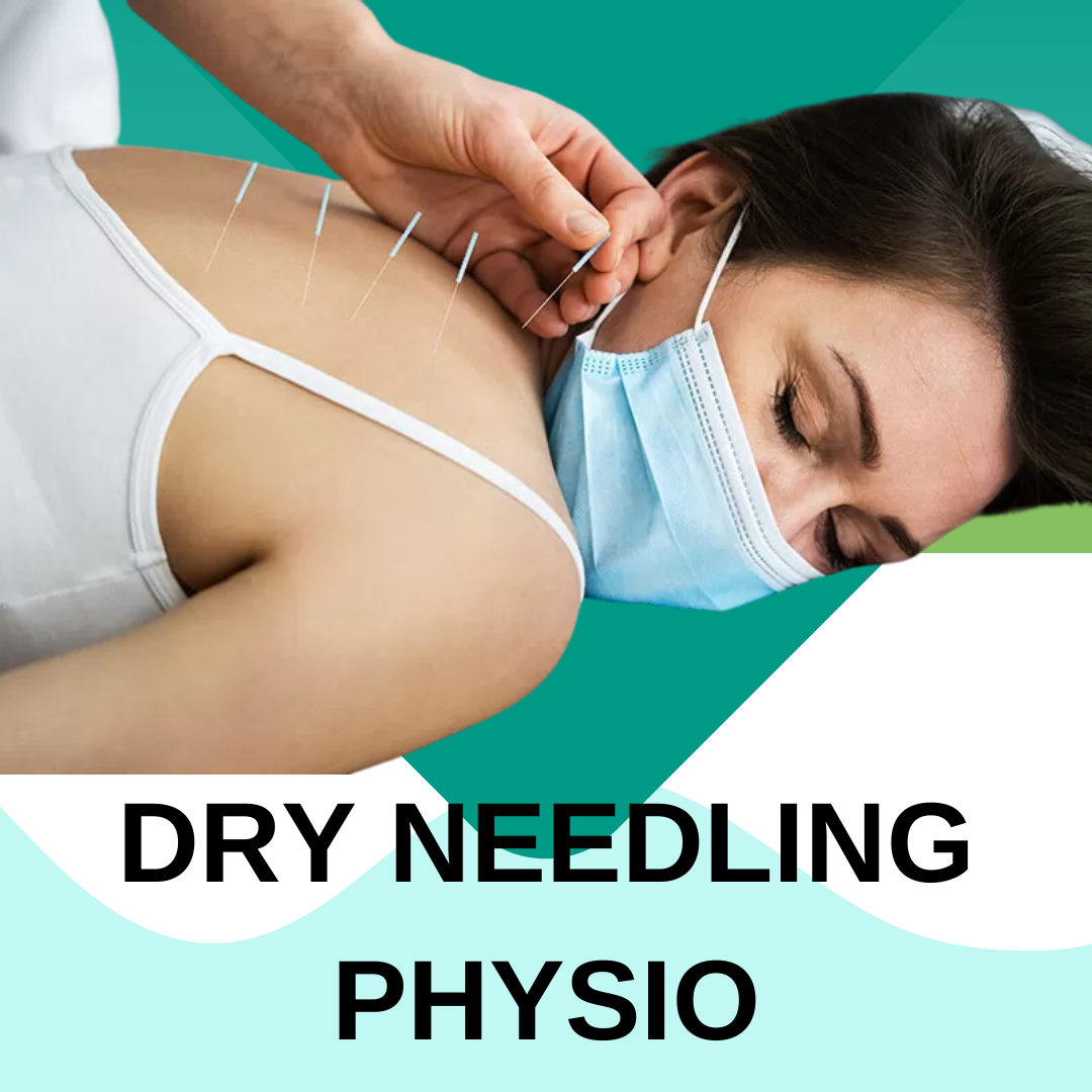 Understanding Dry needling Physio: A Physiotherapy Perspective | Sphere ...