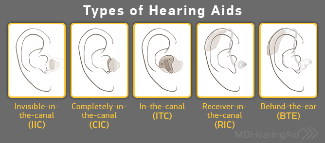 Hearing Aids Styles 10 Amazing Facts About Itc Hearing Aids Sphere