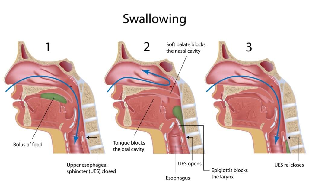Therapy for Swallowing Problems: 8 Proven Swallowing Exercises for ...
